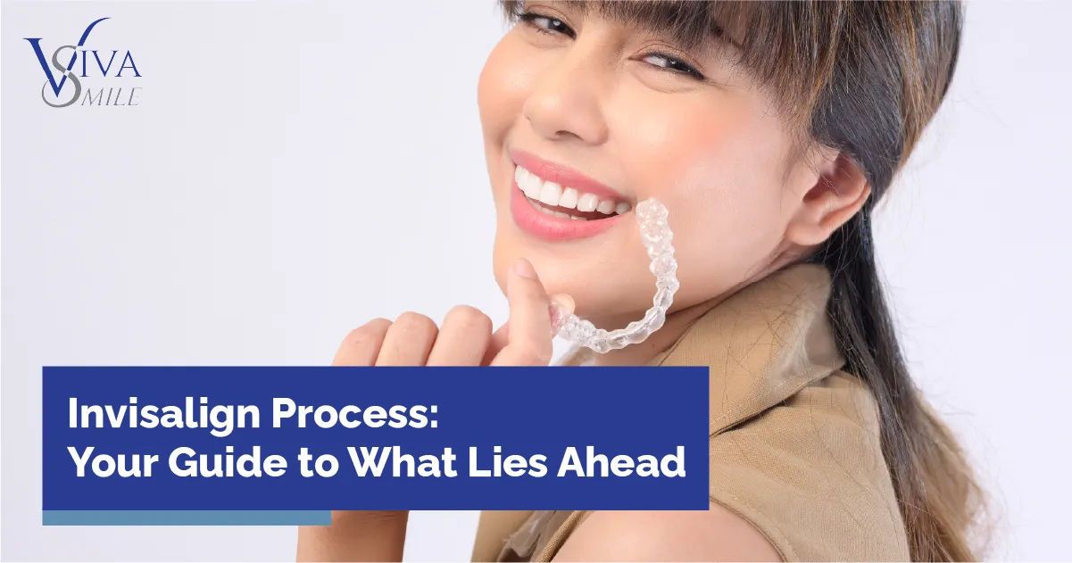 Invisalign Process: Your Guide to What Lies Ahead